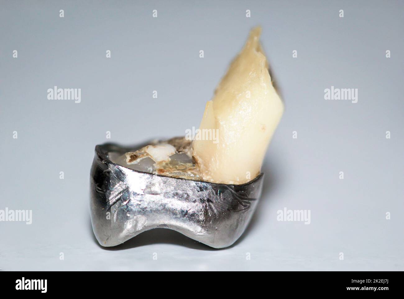 Close-up of a dental crown, together with one half of the root on which ...