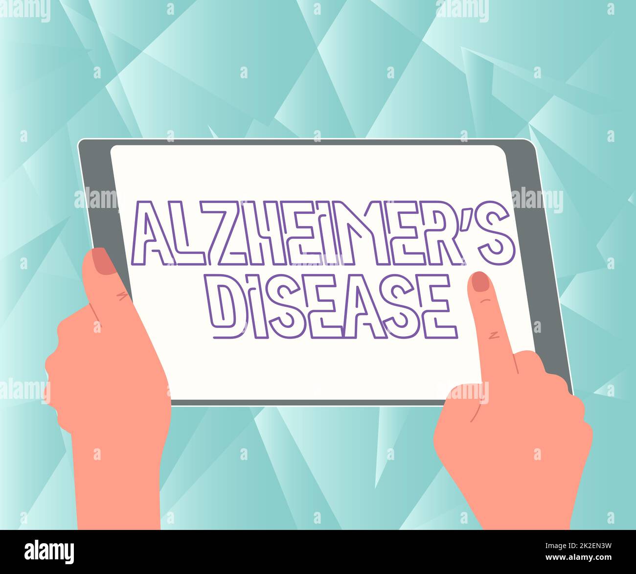 Sign displaying Alzheimer S Is Disease. Word Written on Advanced mental ...