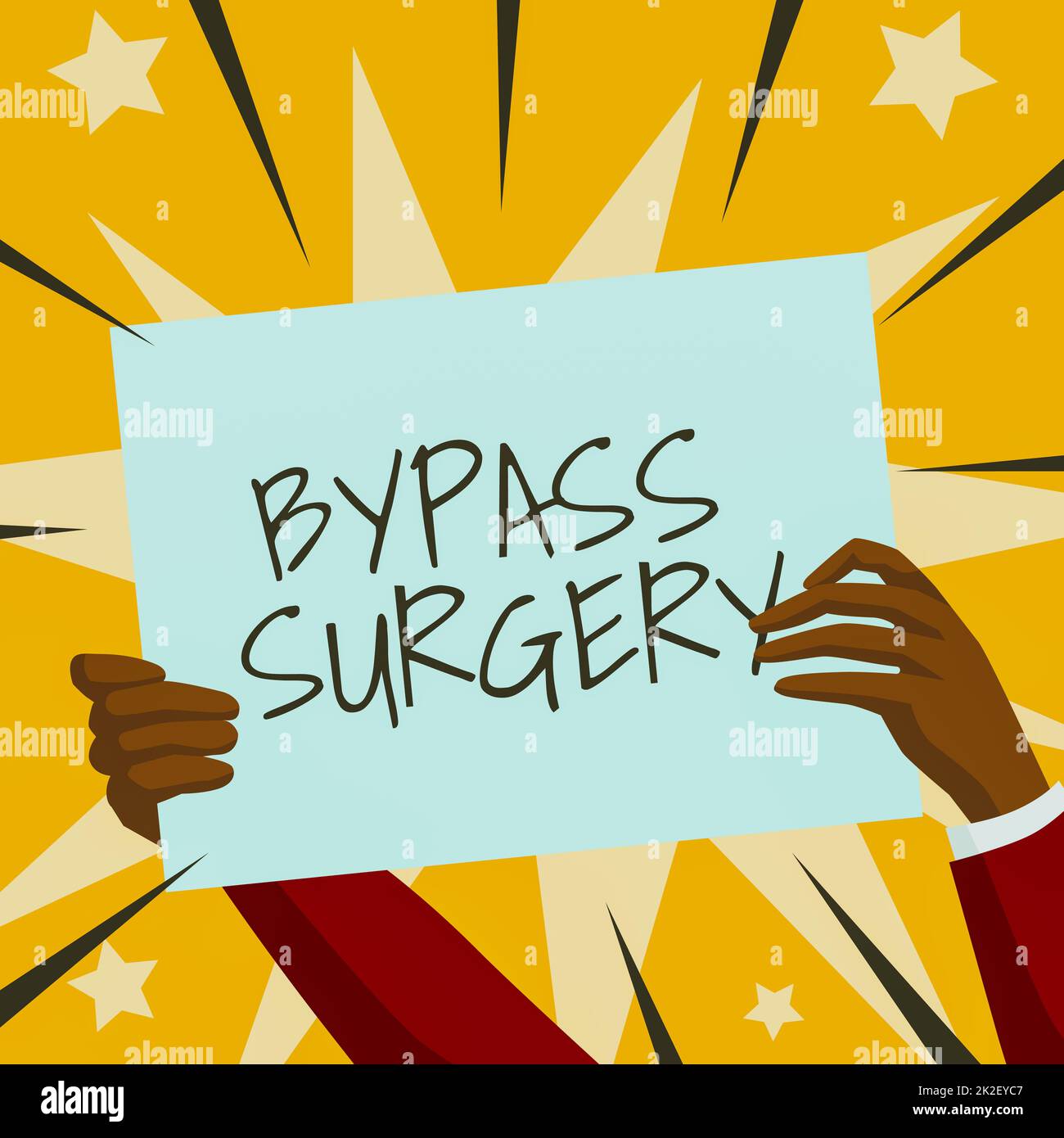 Text sign showing Bypass Surgery. Conceptual photo type of surgery that ...