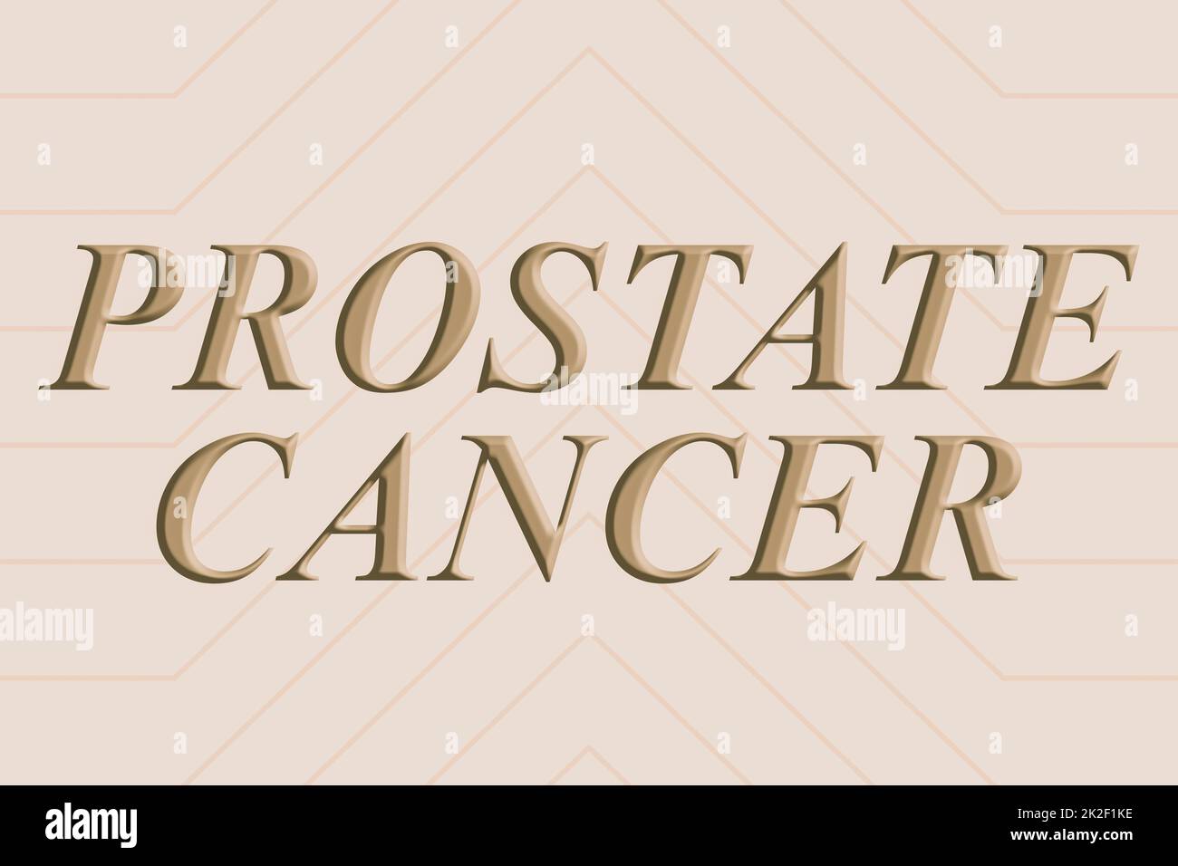 Handwriting text Prostate Cancer. Business overview Cancer that occurs ...