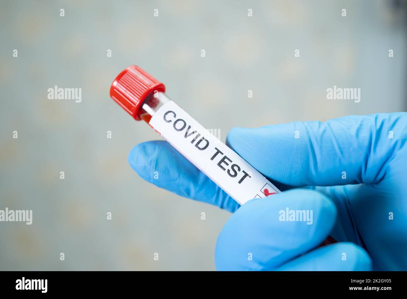 Positive blood infection sample in test tube for covid-19 coronavirus ...
