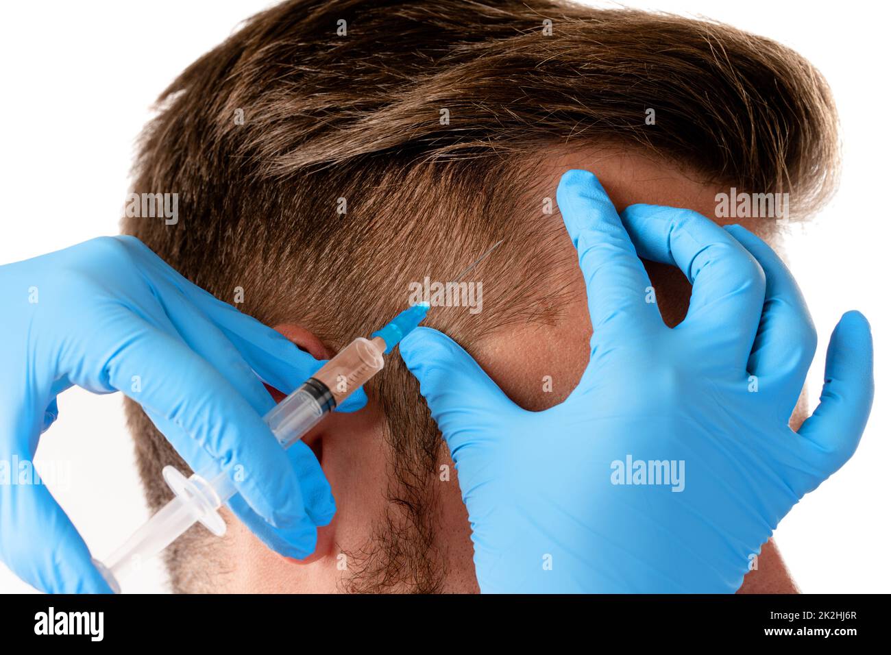 Man receiving scalp injection for hair grow Stock Photo - Alamy
