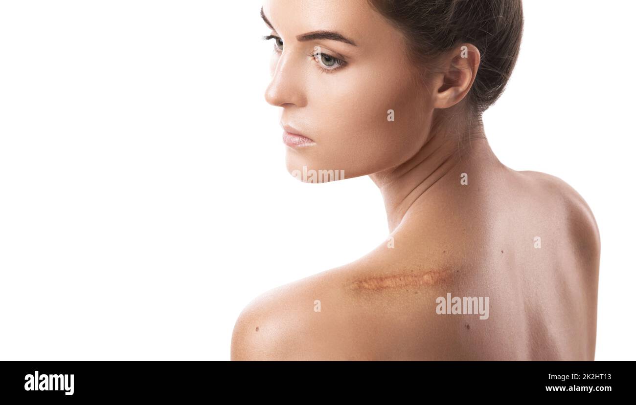 Shoulder scratch hi-res stock photography and images - Alamy