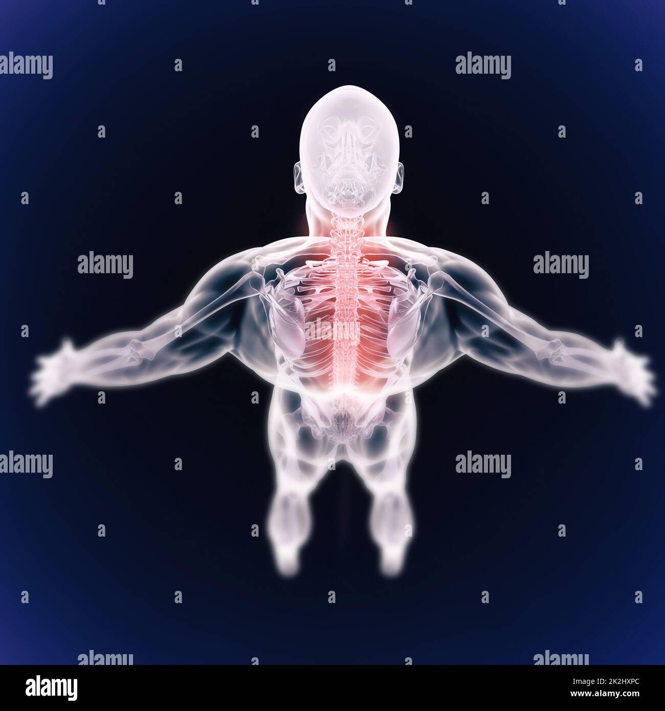 Inflammation pain hi-res stock photography and images - Alamy