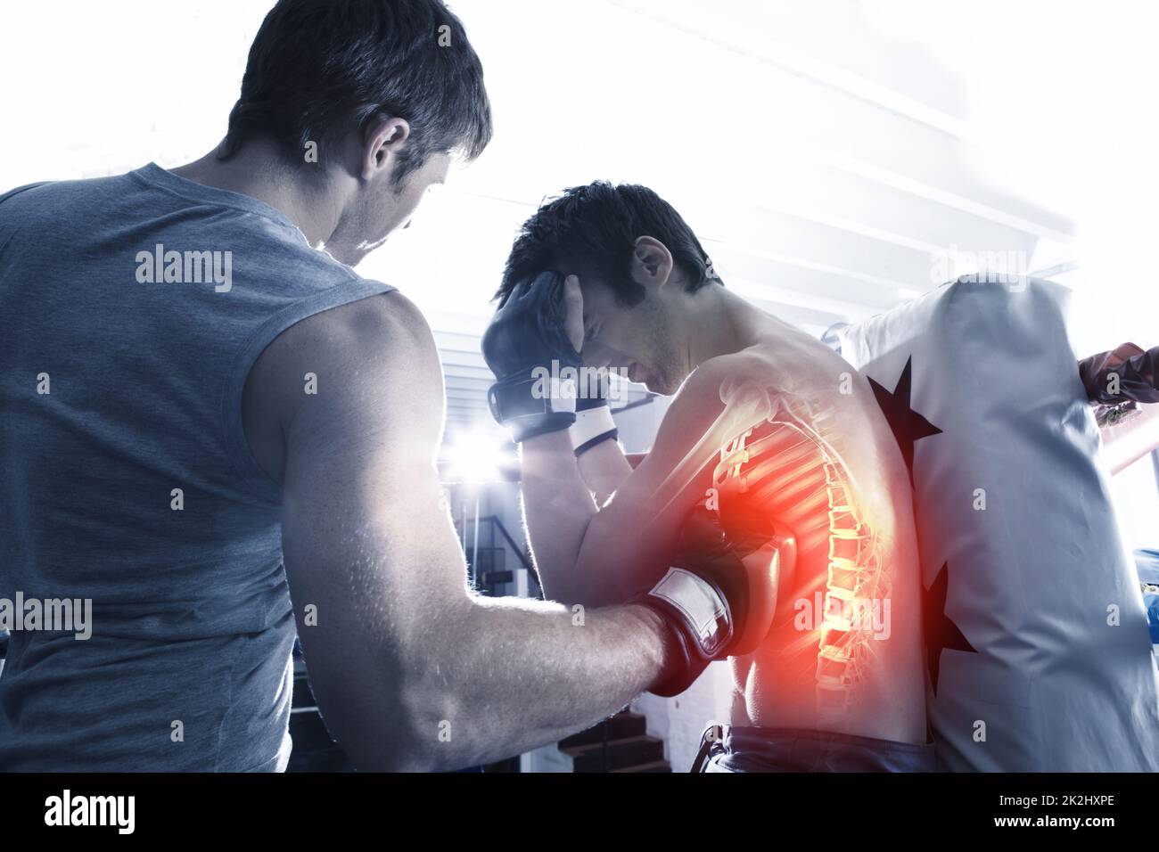 Bone damage hi-res stock photography and images - Alamy