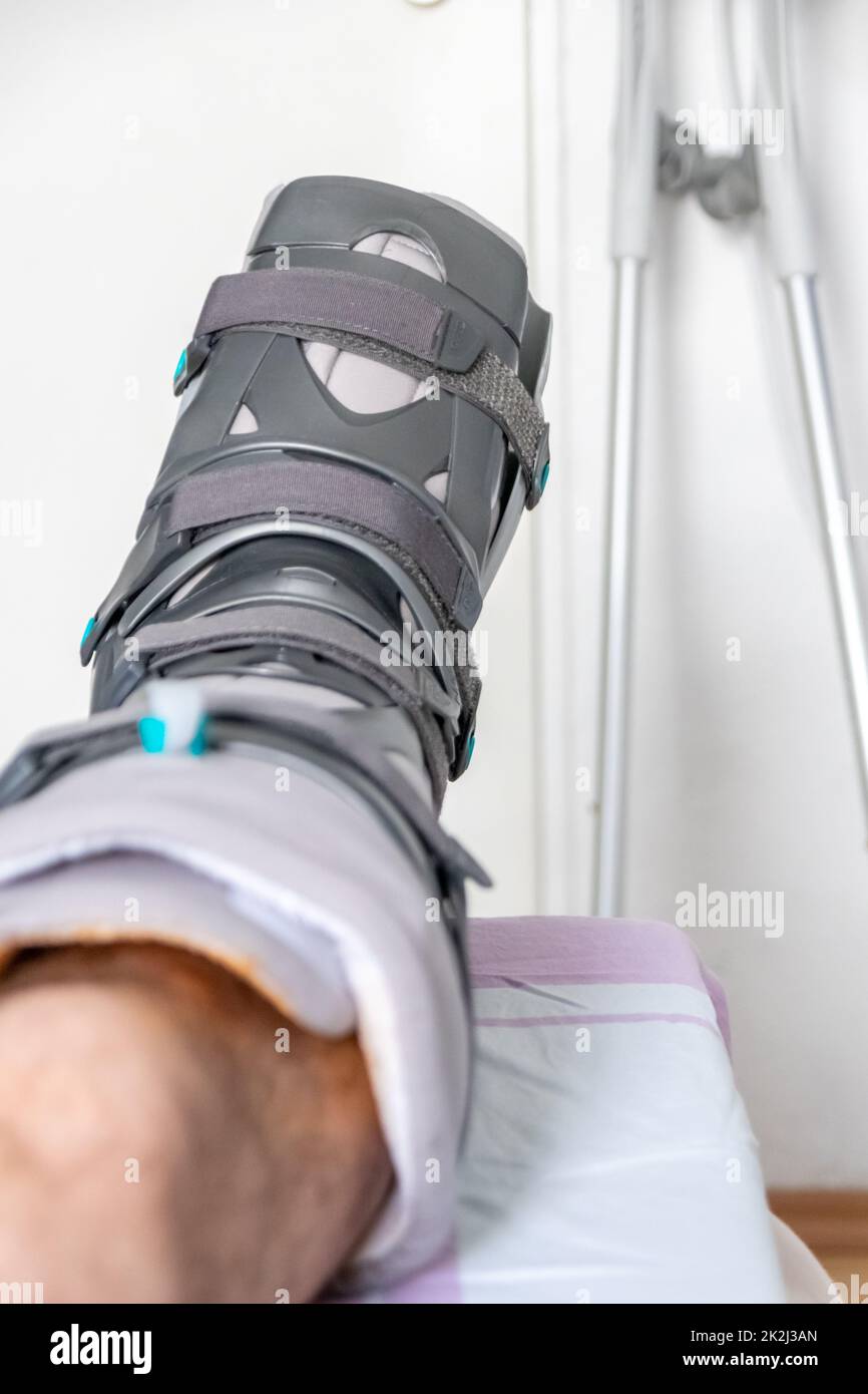 European man after Achilles tendon rupture operation is back home with ...