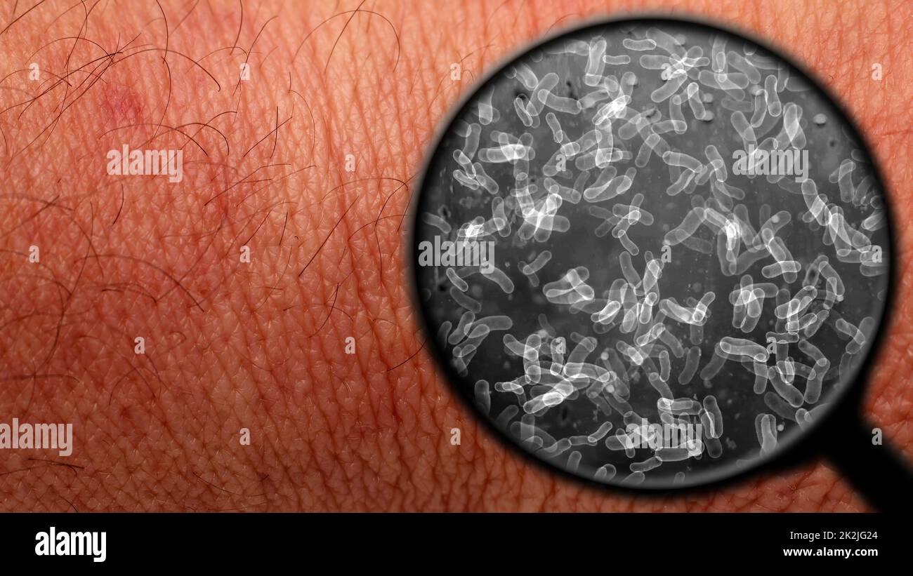 Searching for bacteria on human skin Stock Photo - Alamy