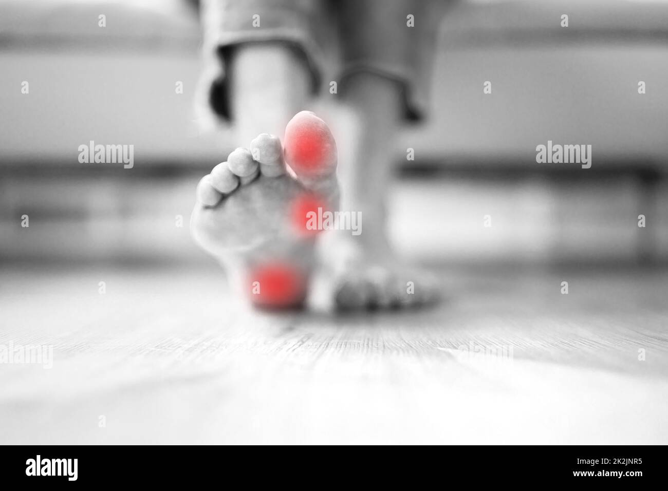 Foot Heel Pain And Callus Care Closeup Stock Photo - Alamy
