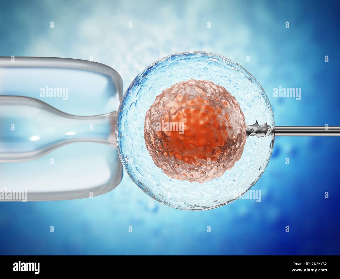 3D illustration of artificial insemination process showings sperms ...