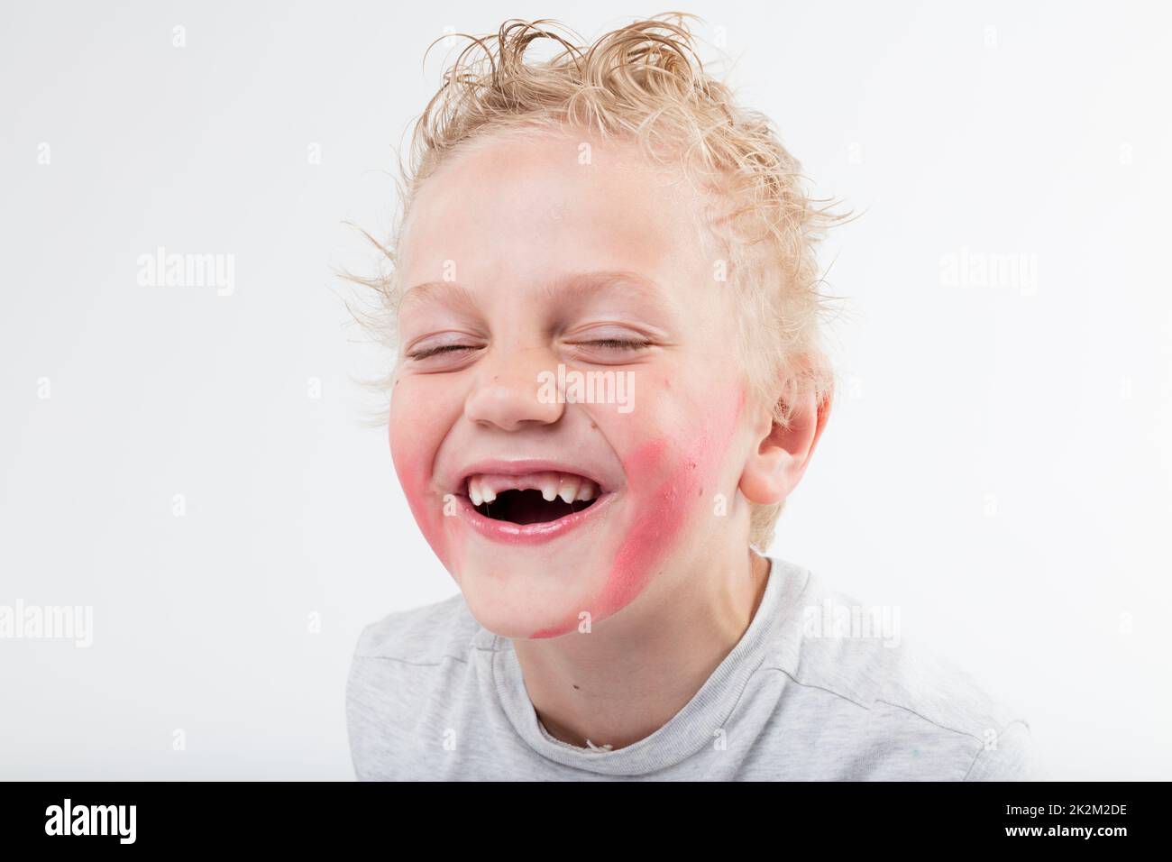 kid baring his windowed teeth laughing Stock Photo - Alamy