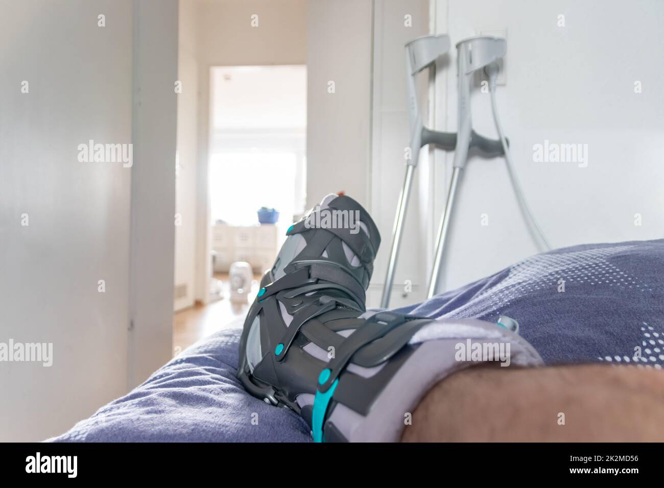 European man after Achilles tendon rupture operation is back home with ...