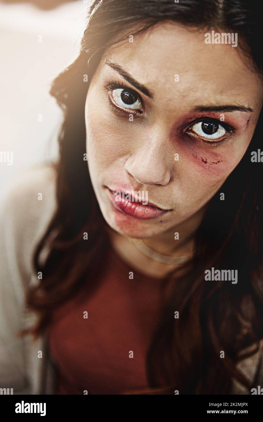 Beaten woman hi-res stock photography and images - Alamy