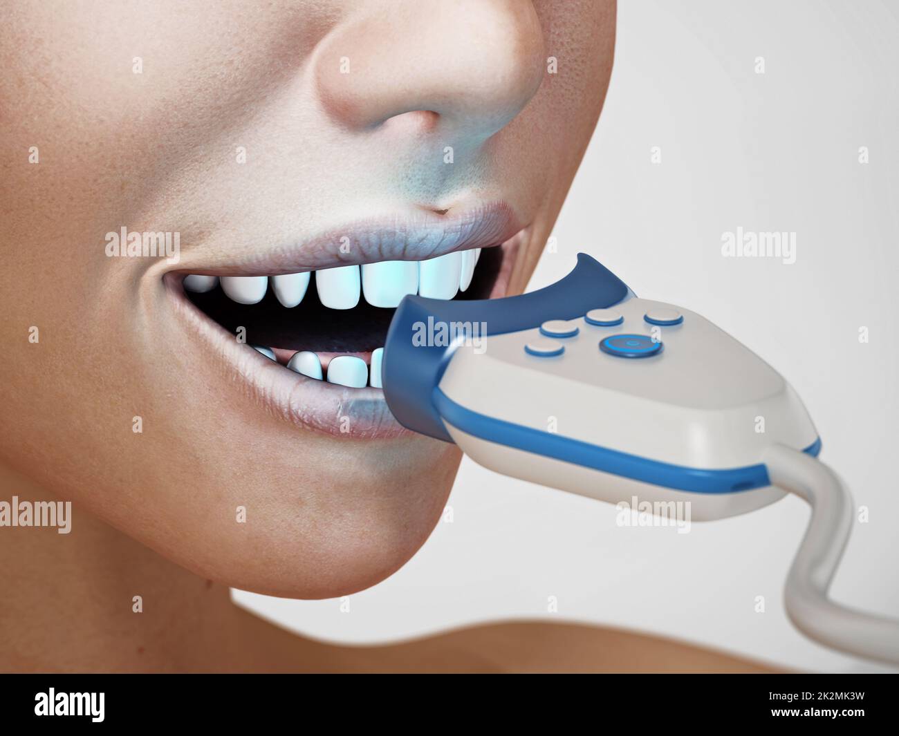 Teeth whitening treatment. 3D illustration Stock Photo - Alamy