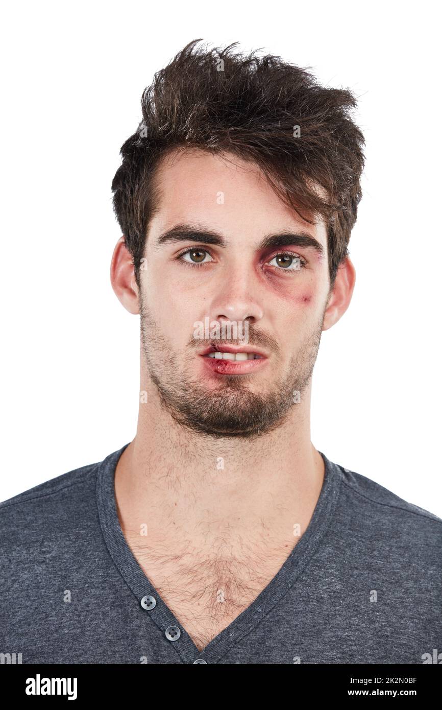 These wounds will heal. Studio portrait of a young man with scratches ...