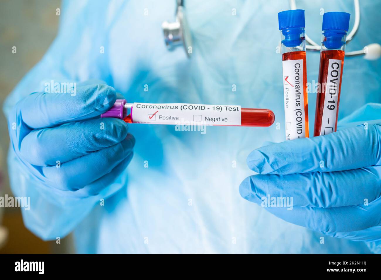 Positive blood infection sample in test tube for covid-19 coronavirus ...