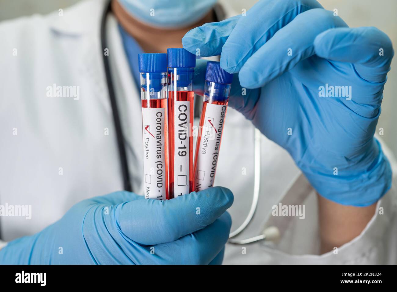 Positive blood infection sample in test tube for covid-19 coronavirus ...