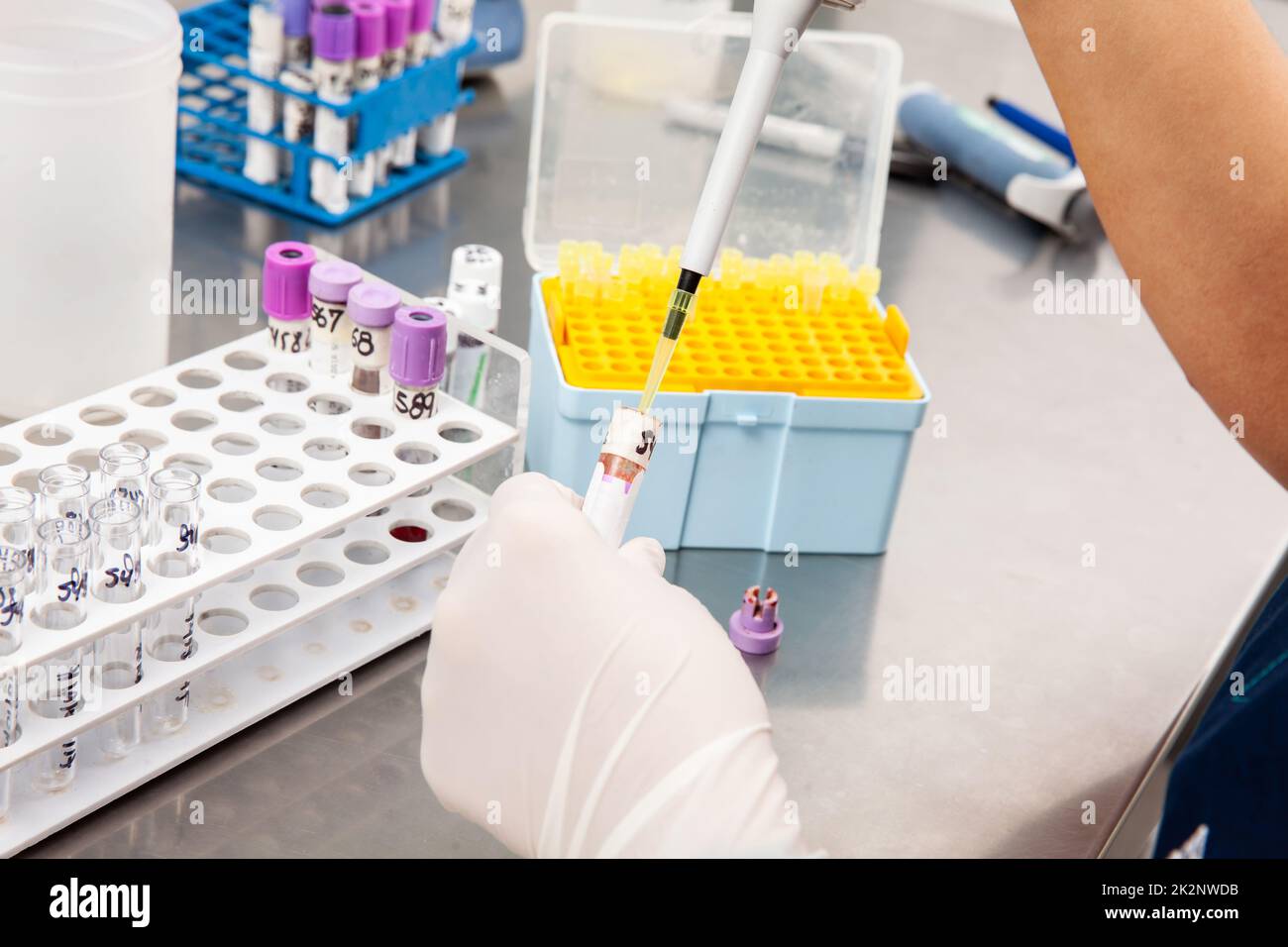 Flow cytometric analysis hi-res stock photography and images - Alamy