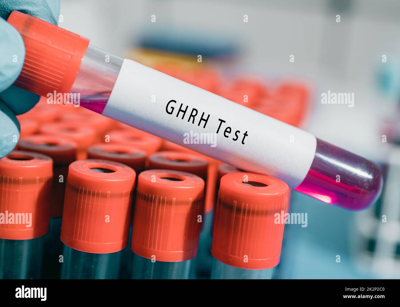 Hypothalamus Growth hormone releasing hormone GHRH Test Regulates ...