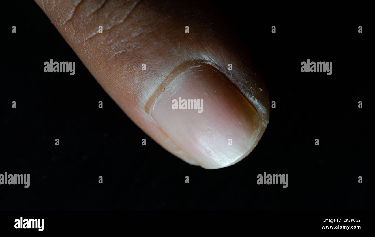 forefinger of the human hand Stock Photo - Alamy