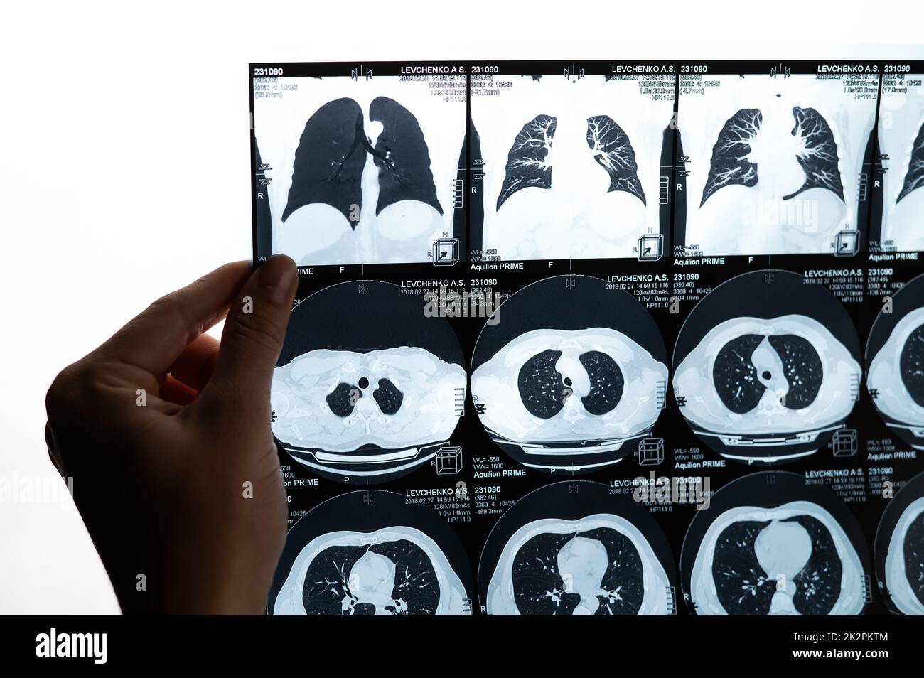 A female doctor examines an MRI scan of the internal organs. Abdomen ...