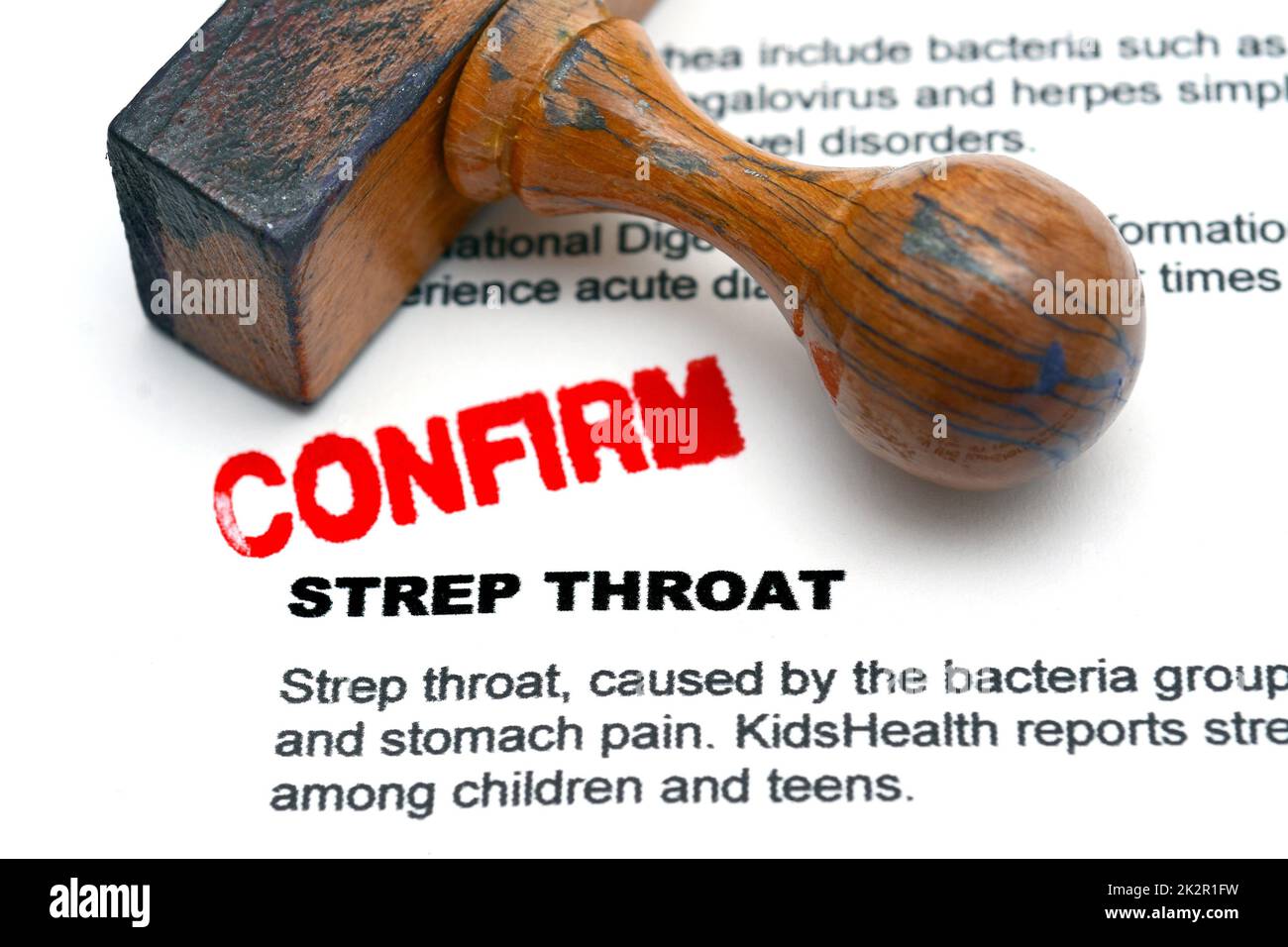 Strep throat confirm Stock Photo - Alamy