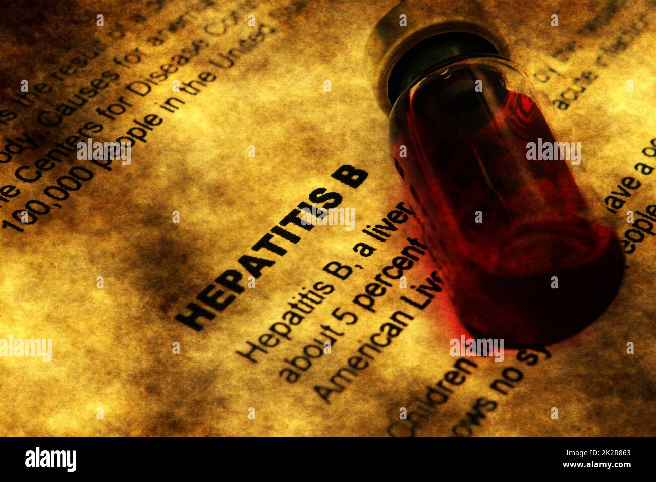 Hepatitis symptoms cirrhosis treatment hi-res stock photography and ...