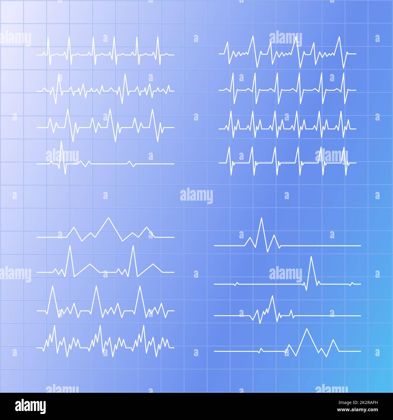 Pulse diagnosis hi-res stock photography and images - Alamy