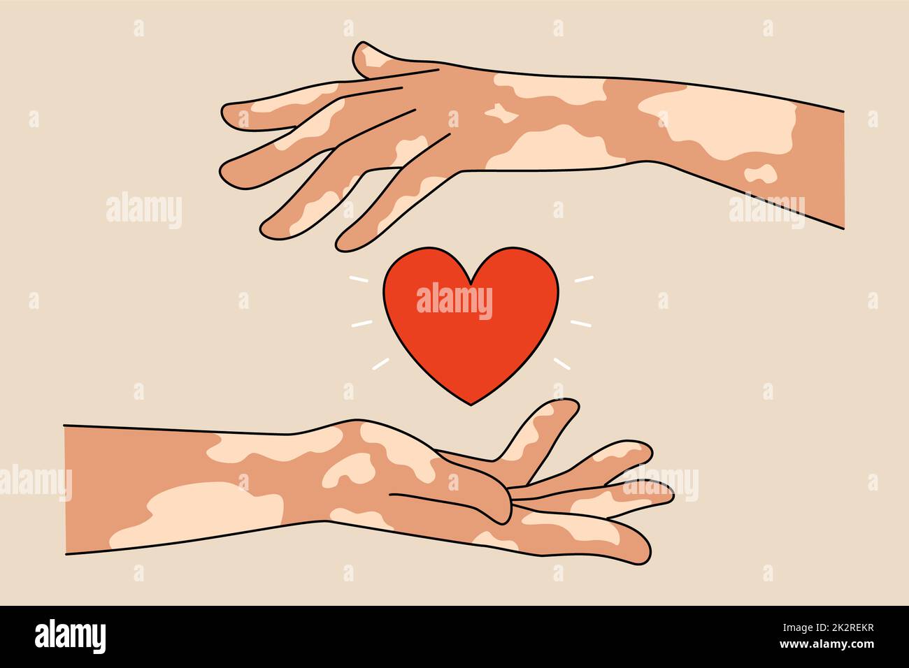 Leprosy hand hi-res stock photography and images - Alamy