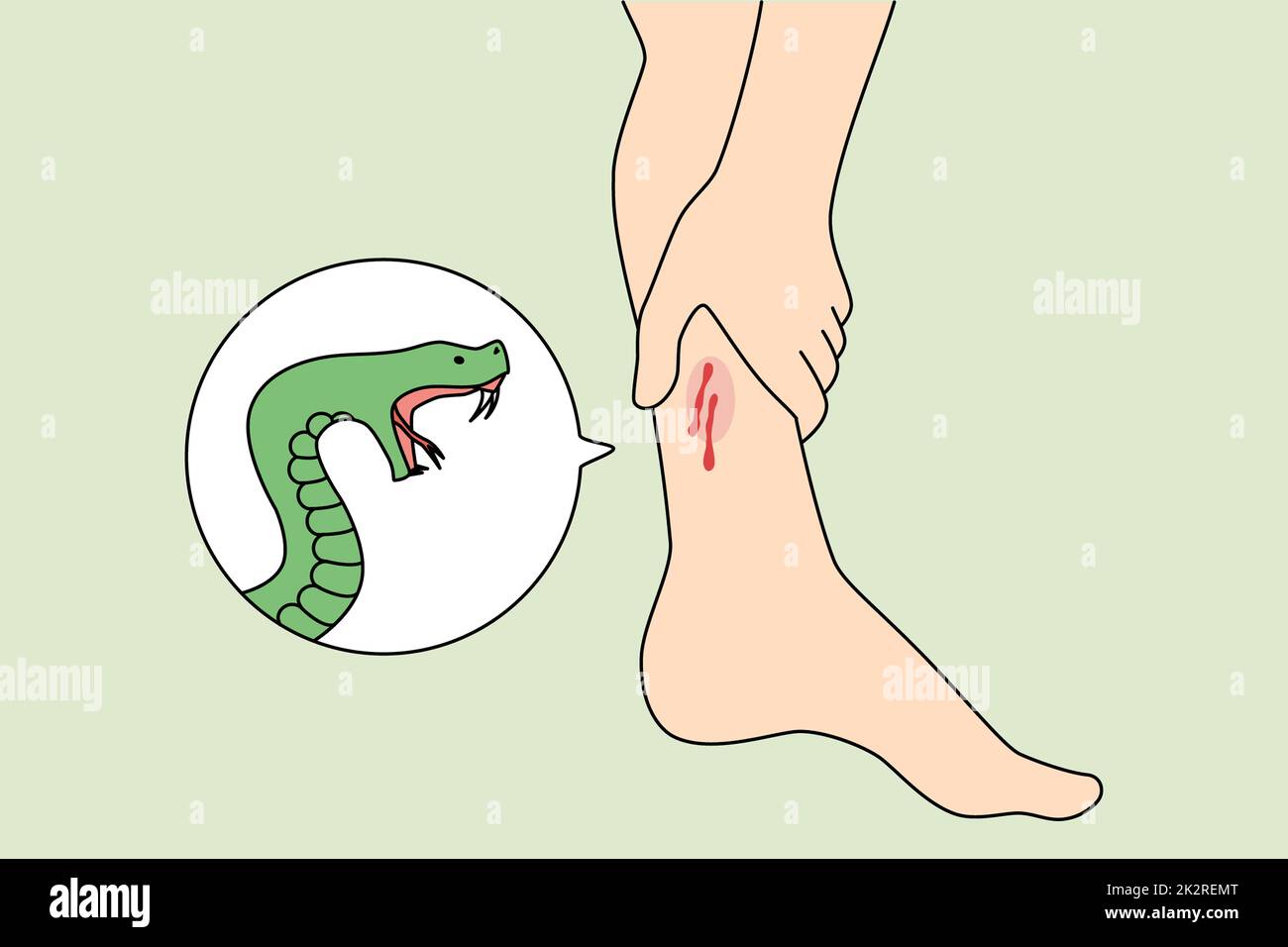 Snake bite person leg Stock Photo - Alamy