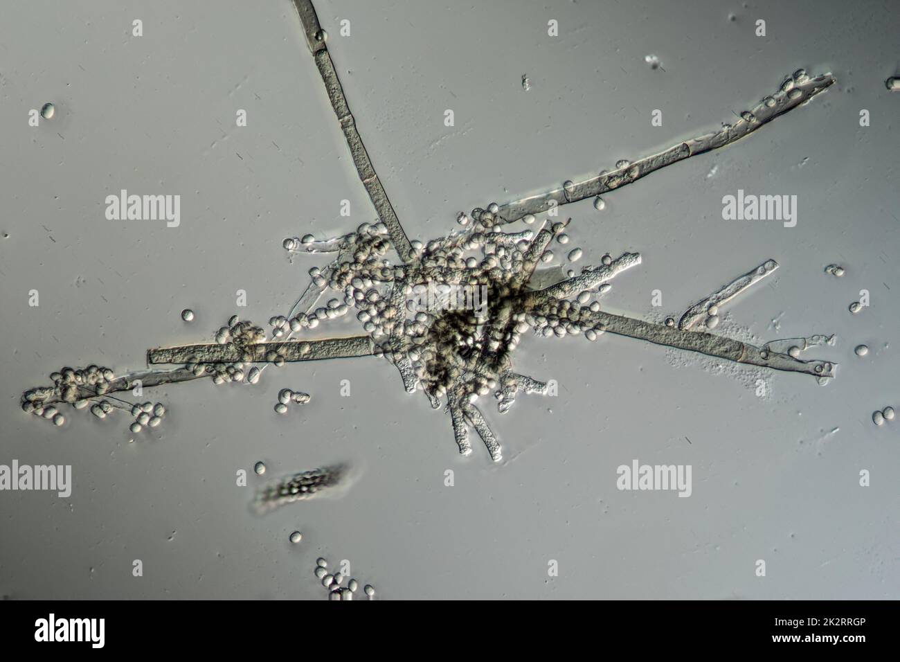 Aspergillus spores hi-res stock photography and images - Alamy