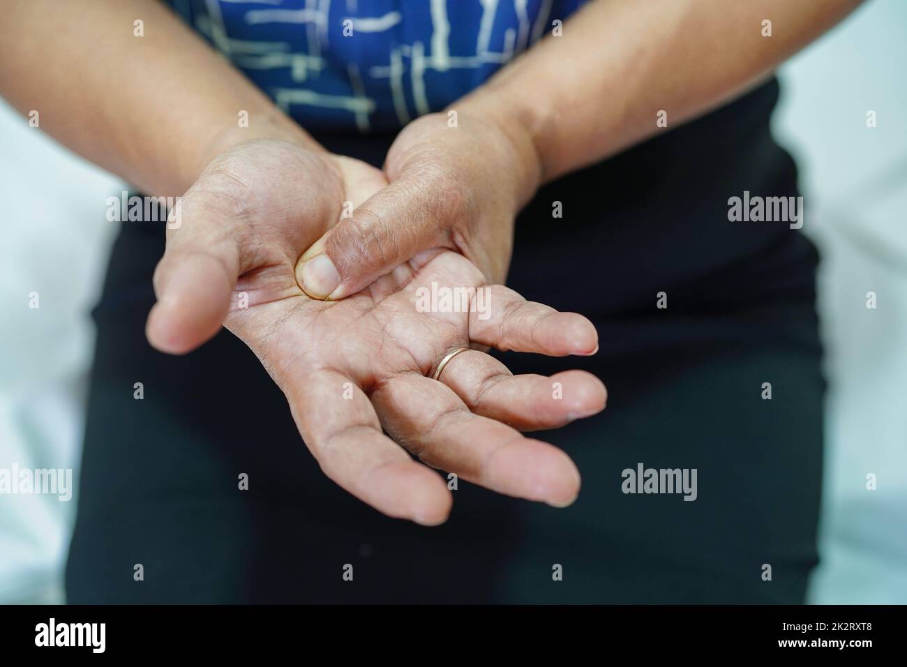 De quervains tenosynovitis hi-res stock photography and images - Alamy