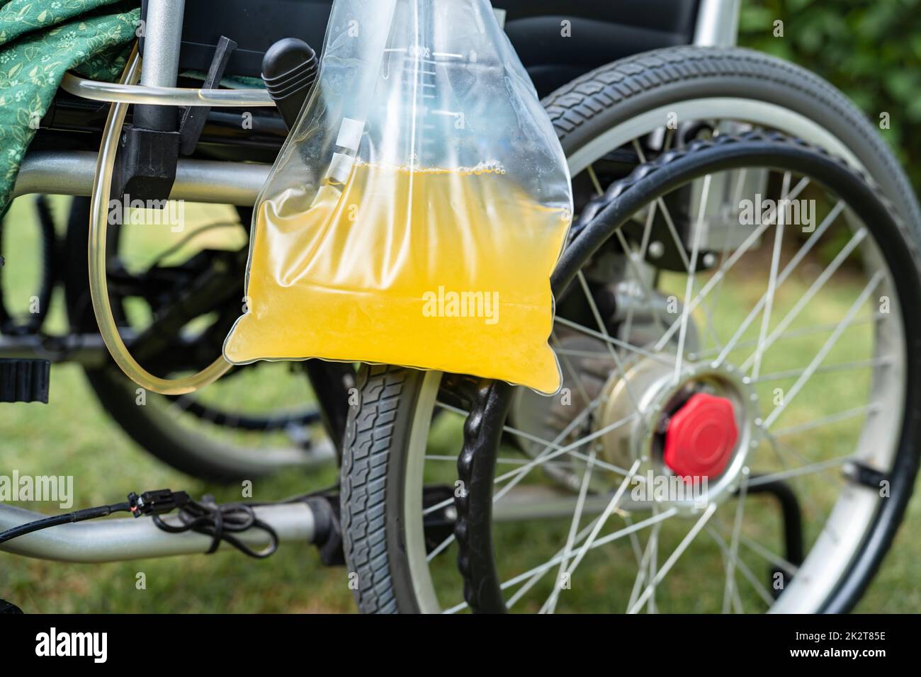 Asian lady woman patient sitting on wheelchair with urine bag in the ...