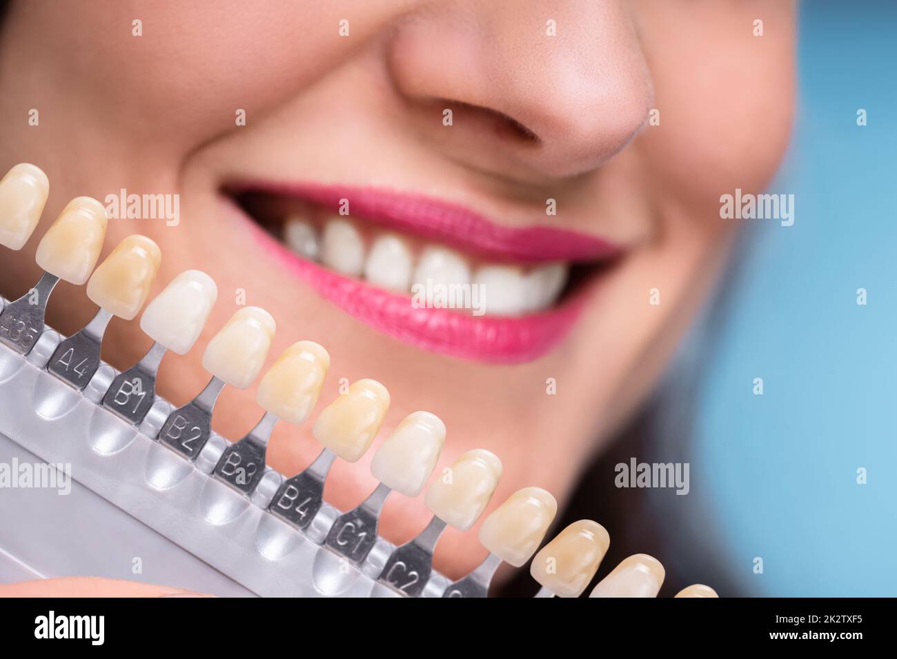 Woman Matching Shade Of The Implant Teeth Stock Photo - Alamy