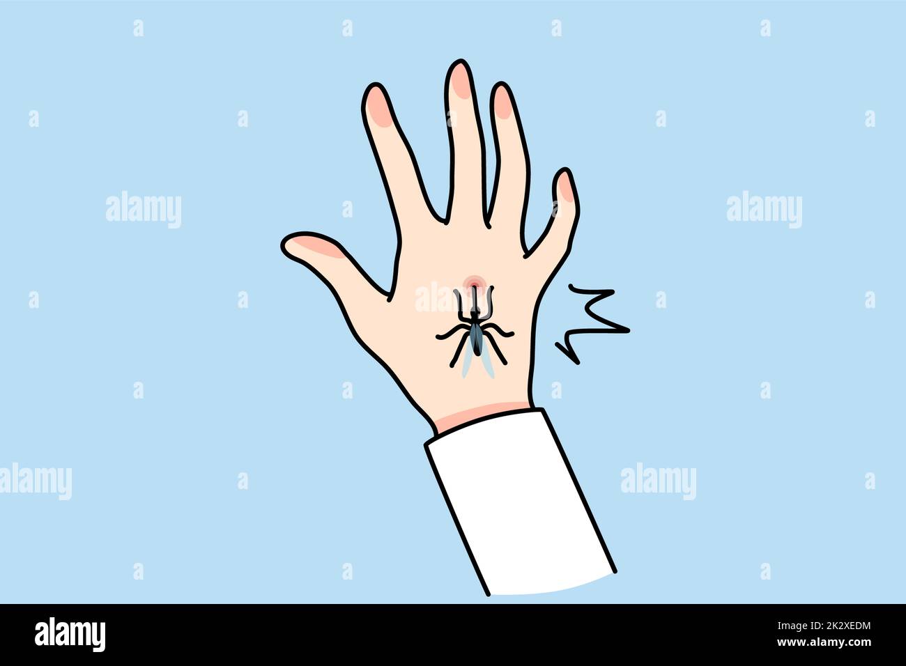 Mosquito bite person hand Stock Photo - Alamy