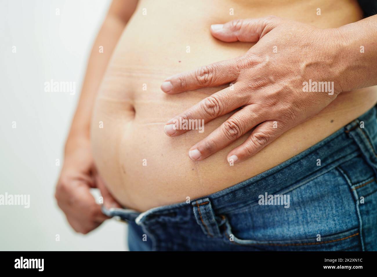 Asian woman show fat belly big size overweight and obesity at office ...