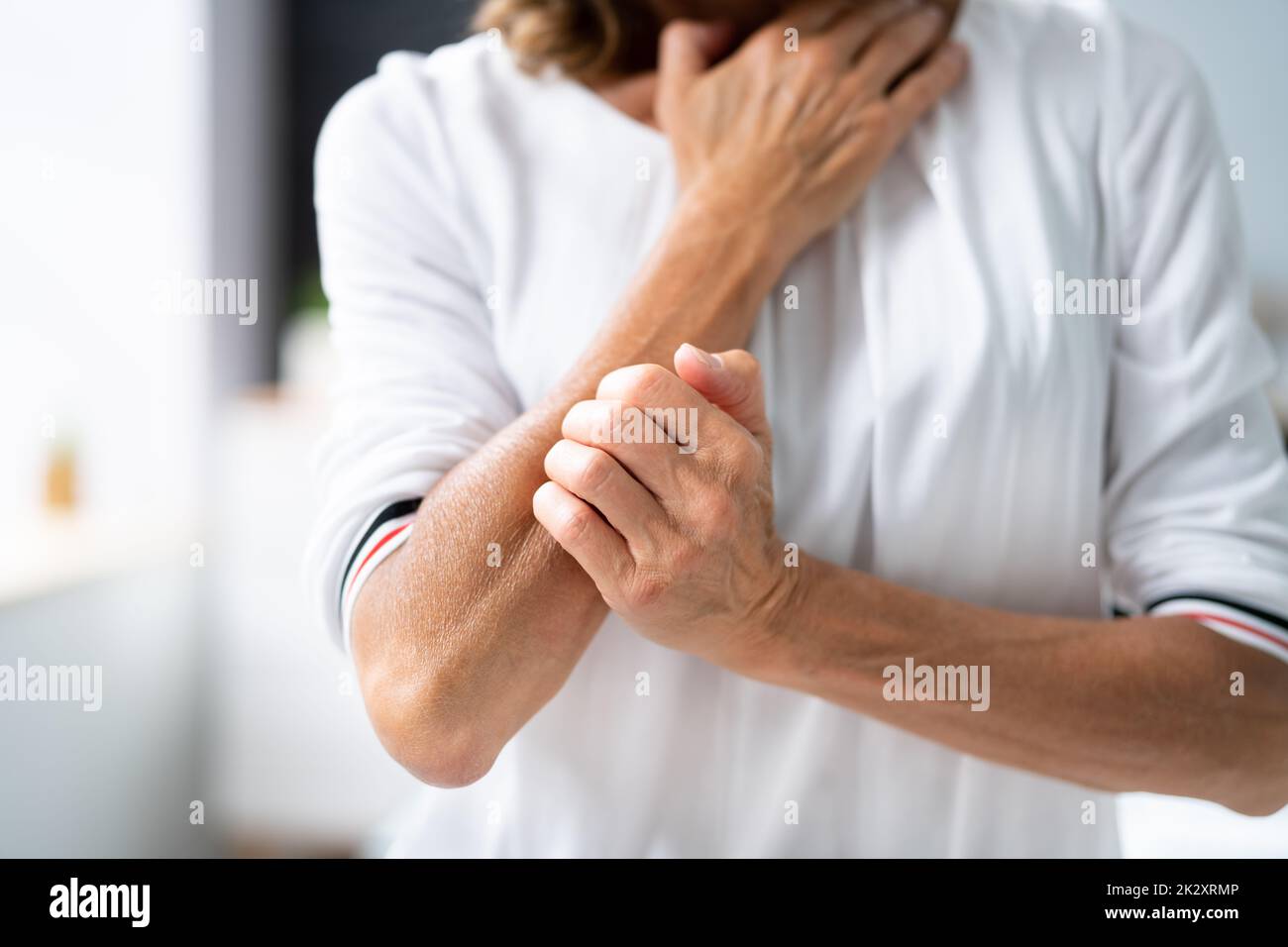 Woman Scratching Itching Body Skin Stock Photo - Alamy