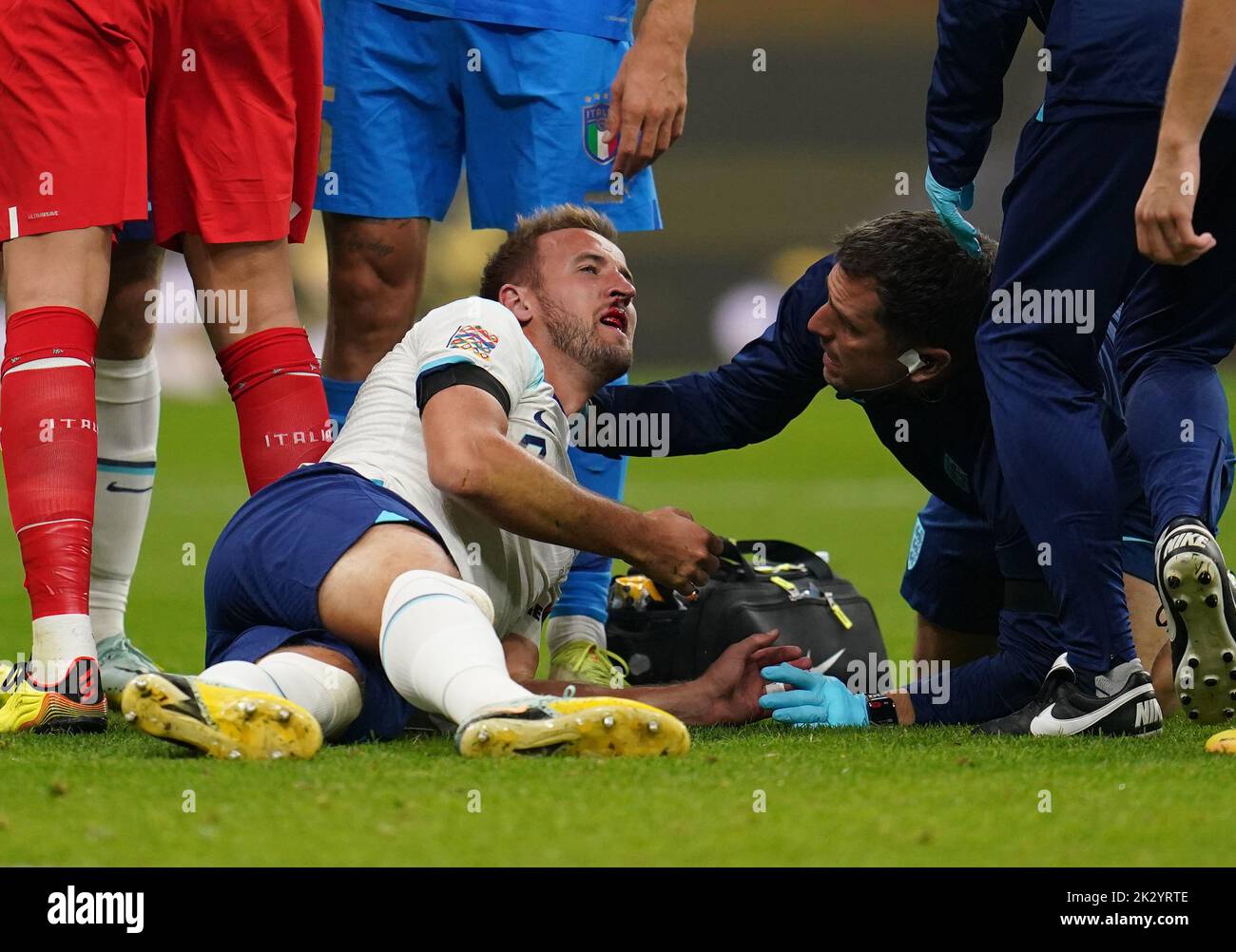 England's Harry Kane receives treatment after a clash of heads during ...
