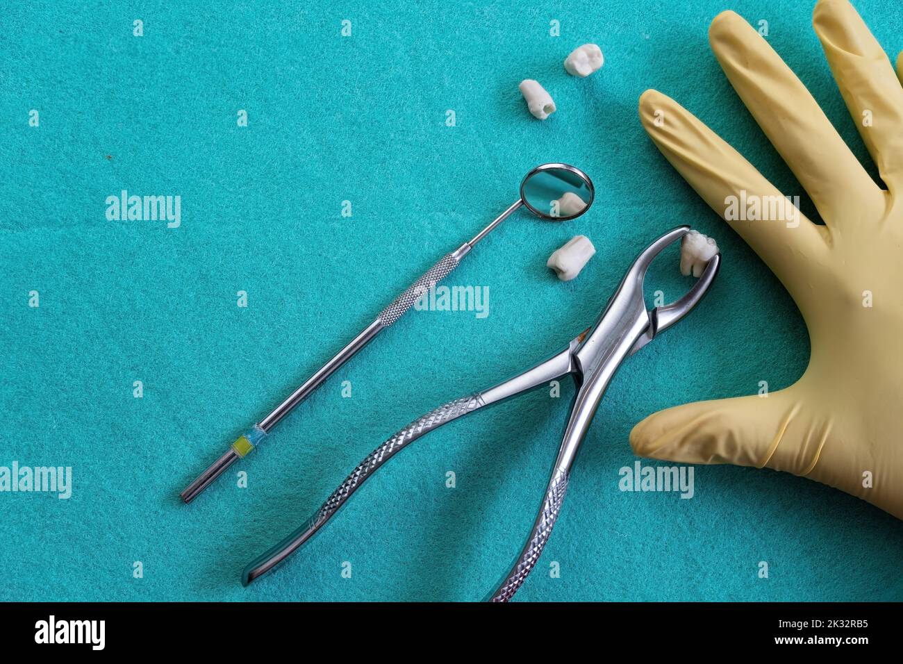 A closeup of removed teeth with extraction forceps with the blue ...