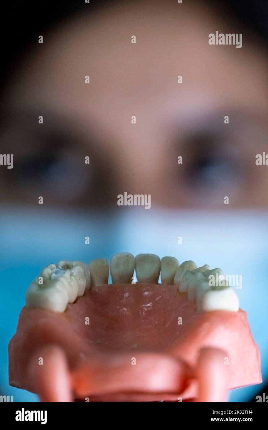 A closeup of a dentist holding a ceramic tooth mold with a yellow glove ...