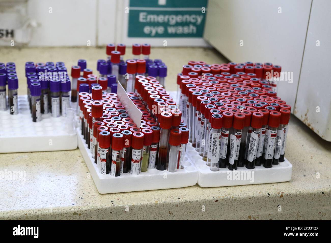 Blood samples for testing are seen placed on the table at Nakuru Blood ...