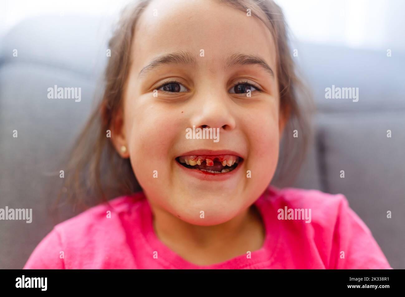 closeup portrait of funny smiling little girl without one front tooth ...