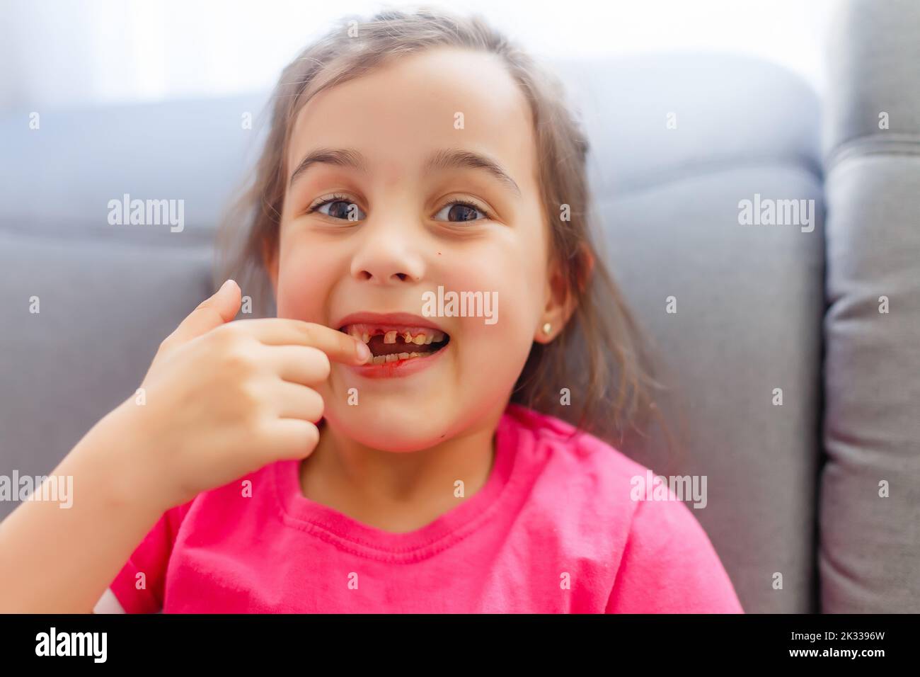 little girl pointing her missing teeth Stock Photo - Alamy