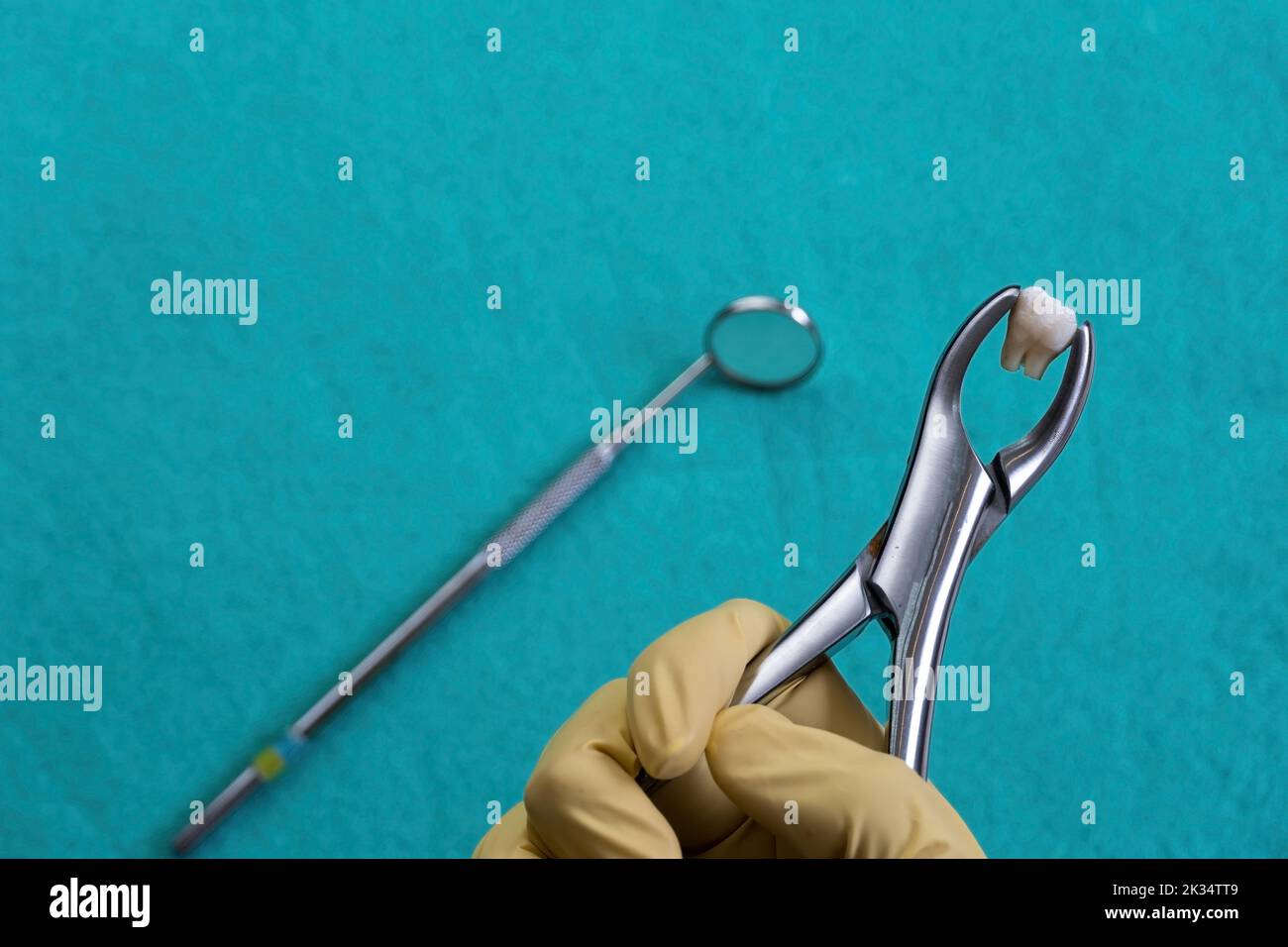 A closeup of a tooth extraction with forceps on a blue surface Stock ...