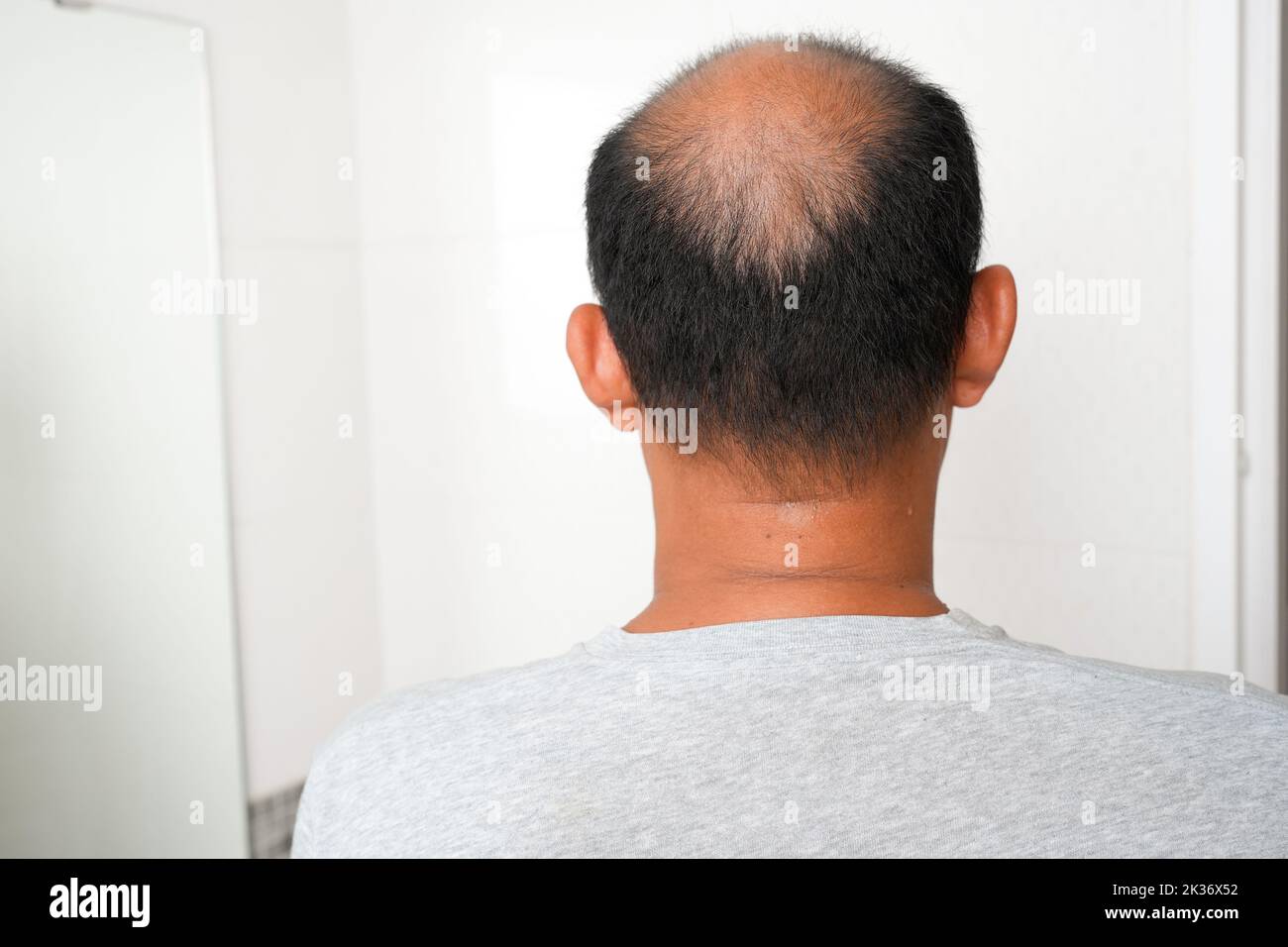 A back view of partially bald man standing in white room Stock Photo ...