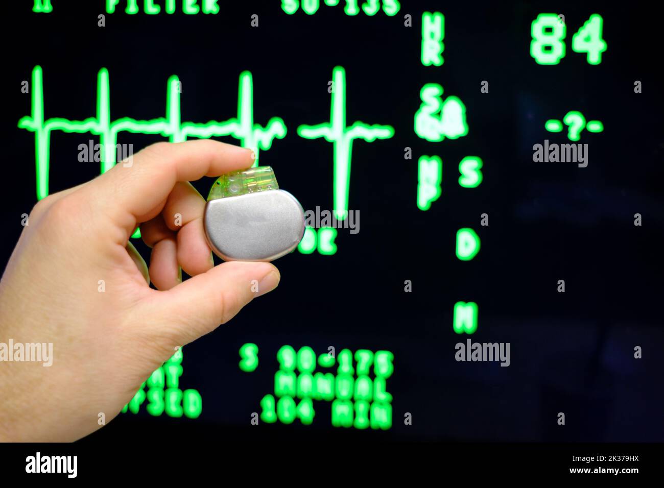 an implantable pacemaker is held in front of an ECG monitor Stock Photo ...