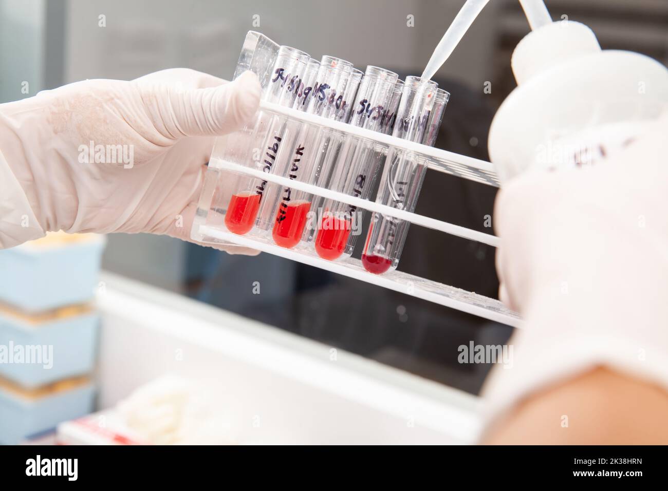 Flow cytometric analysis hi-res stock photography and images - Alamy