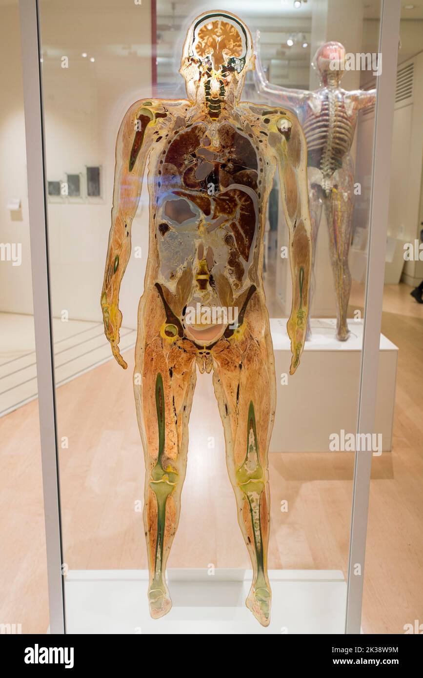 sectioned human male Stock Photo - Alamy