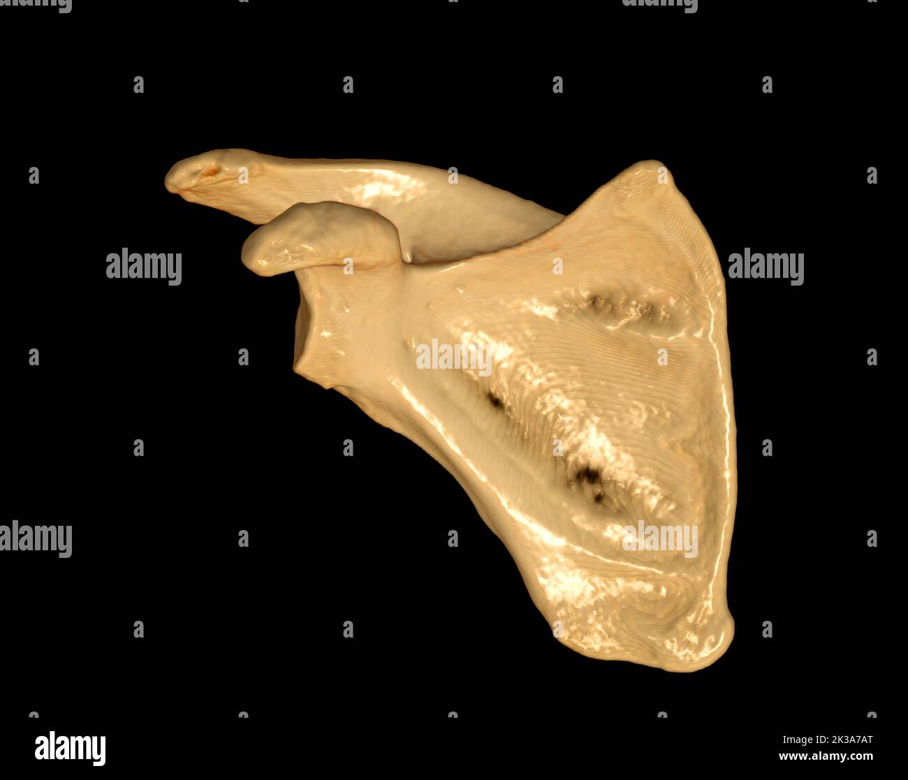 CT Shoulder 3D of Computed Tomography Volume Rendering examination of ...