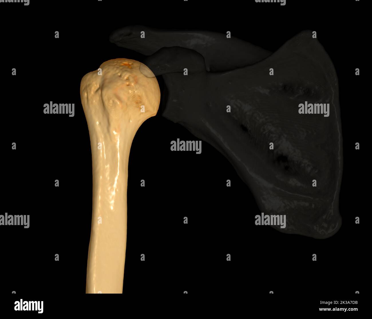 CT Shoulder 3D of Computed Tomography Volume Rendering examination of ...