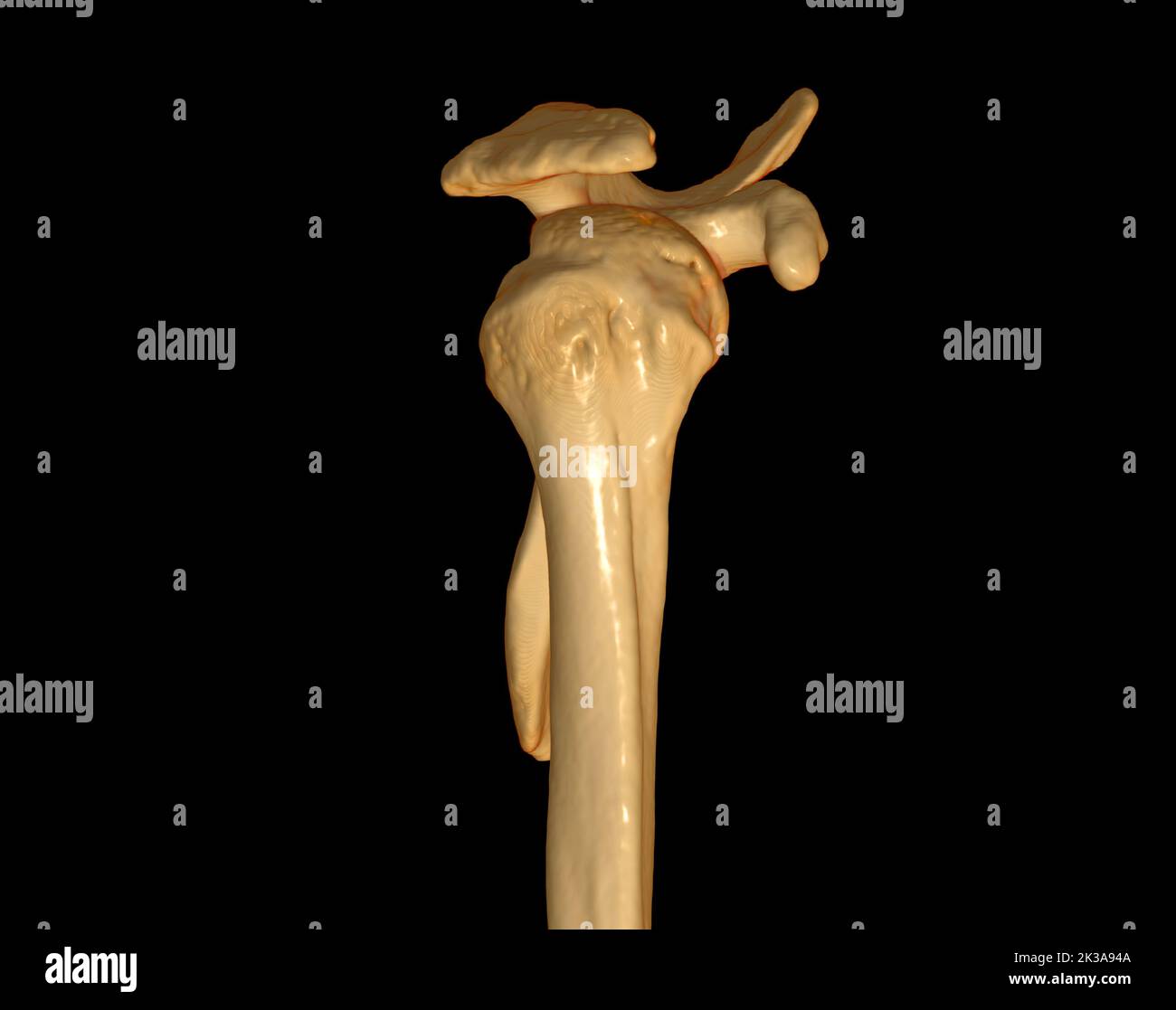 CT Shoulder 3D of Computed Tomography Volume Rendering examination of ...